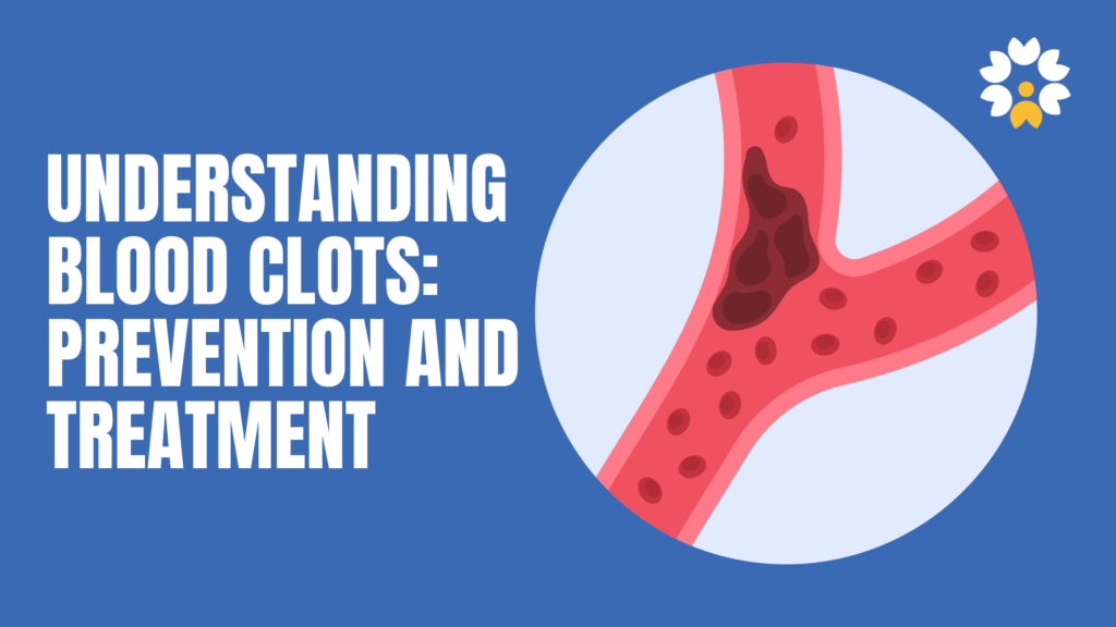 Understanding Blood Clots: Prevention and Treatment - Novo Solitaire Care